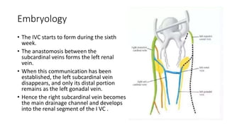 Retrocaval Ureter Urology Anatomy and Management | PPTX