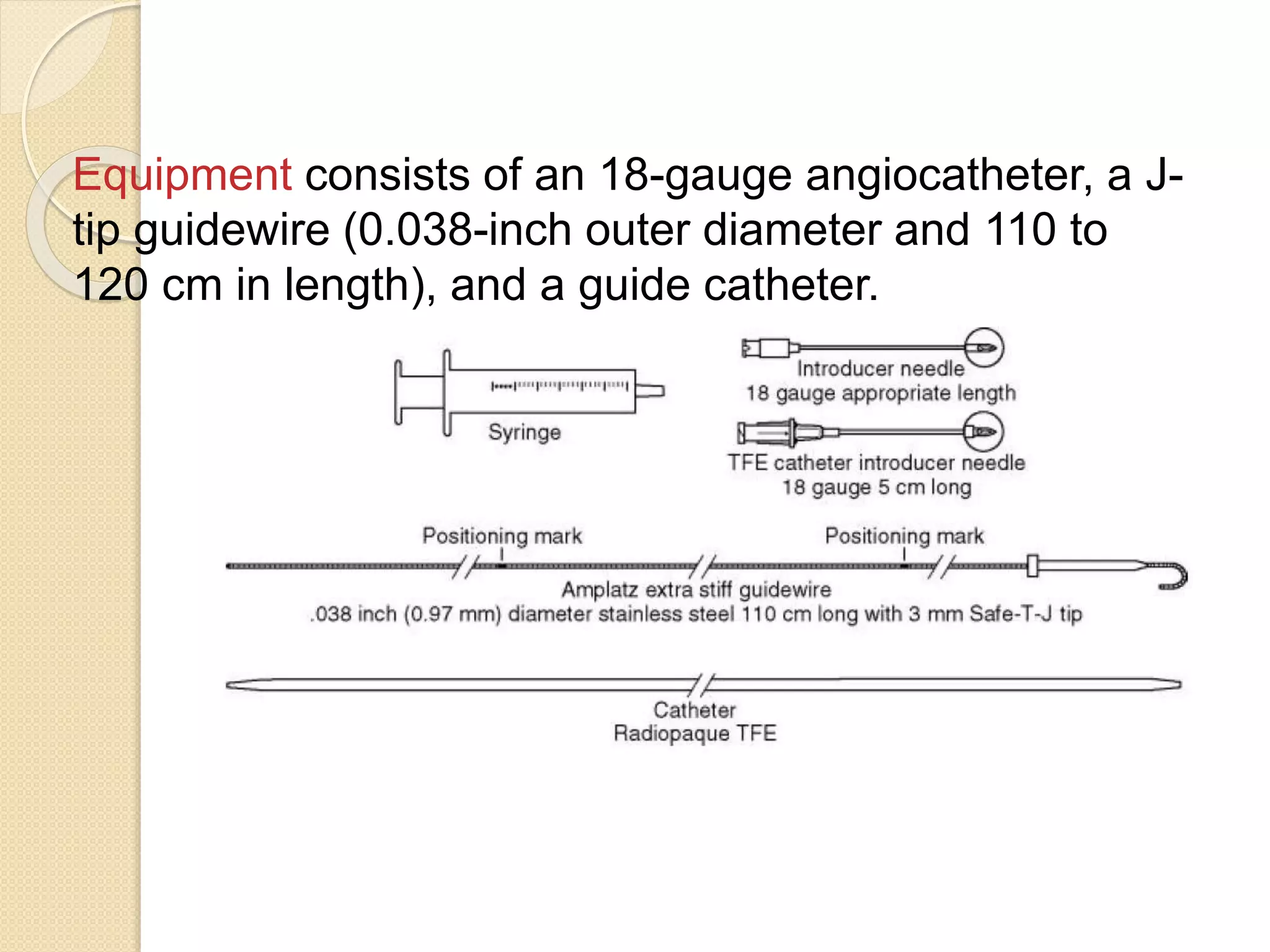 Retrograde intubation | PPTX