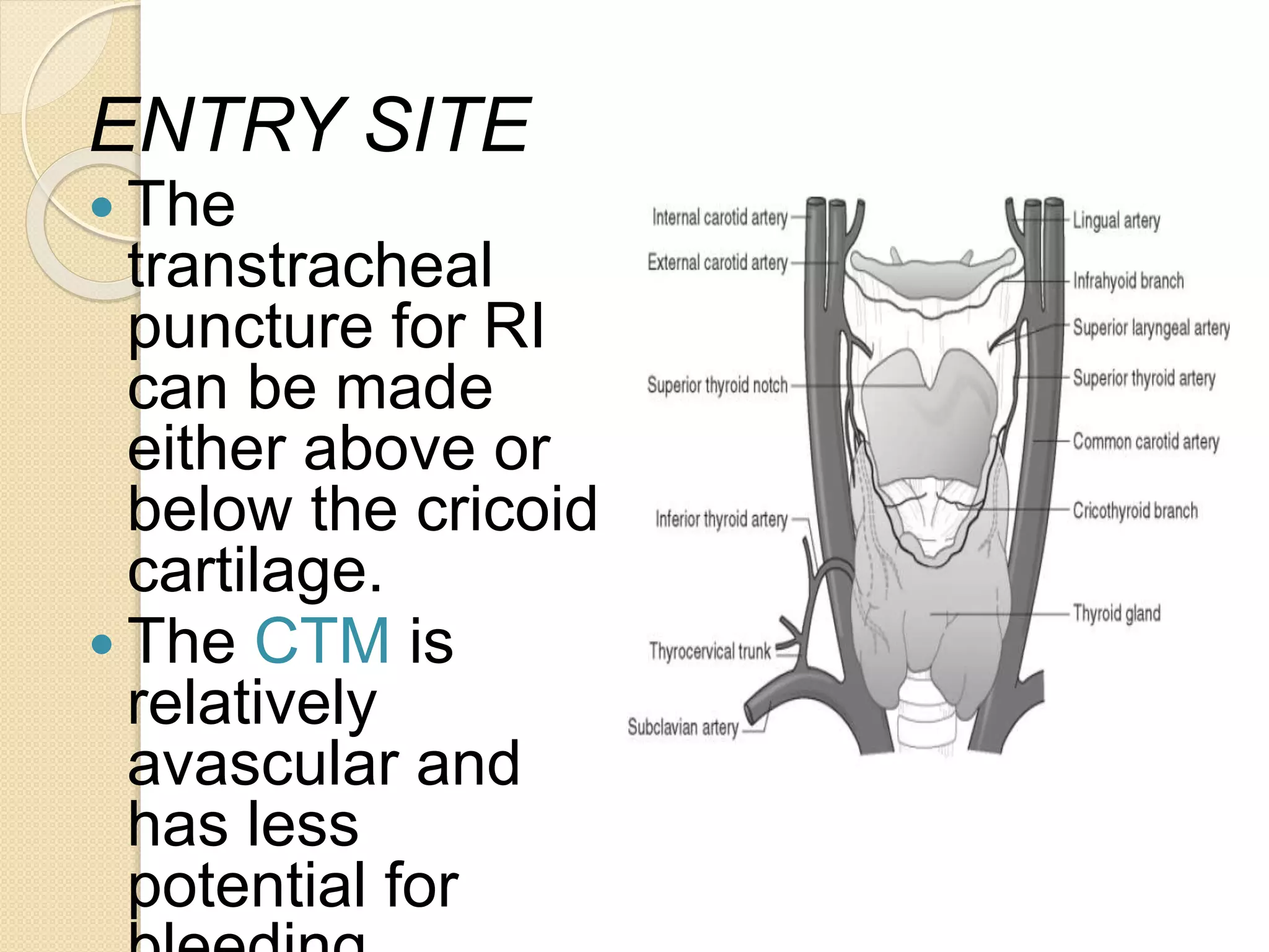 Retrograde intubation | PPTX