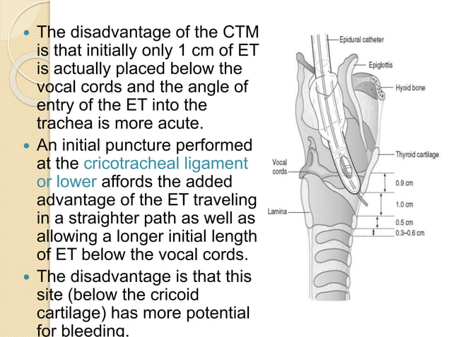 Retrograde intubation | PPTX | First Aid | Injuries