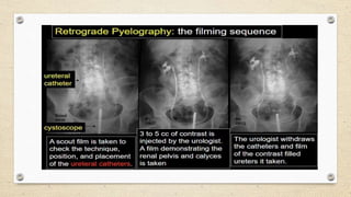 Retrograde pyeloureterography | PPTX