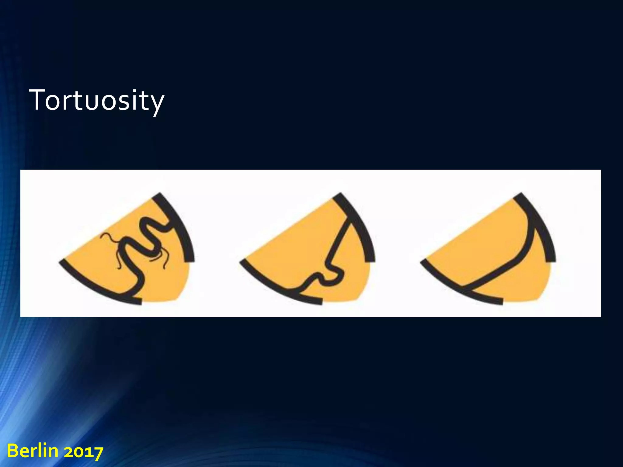 Retrograde – step by step approach | PPTX