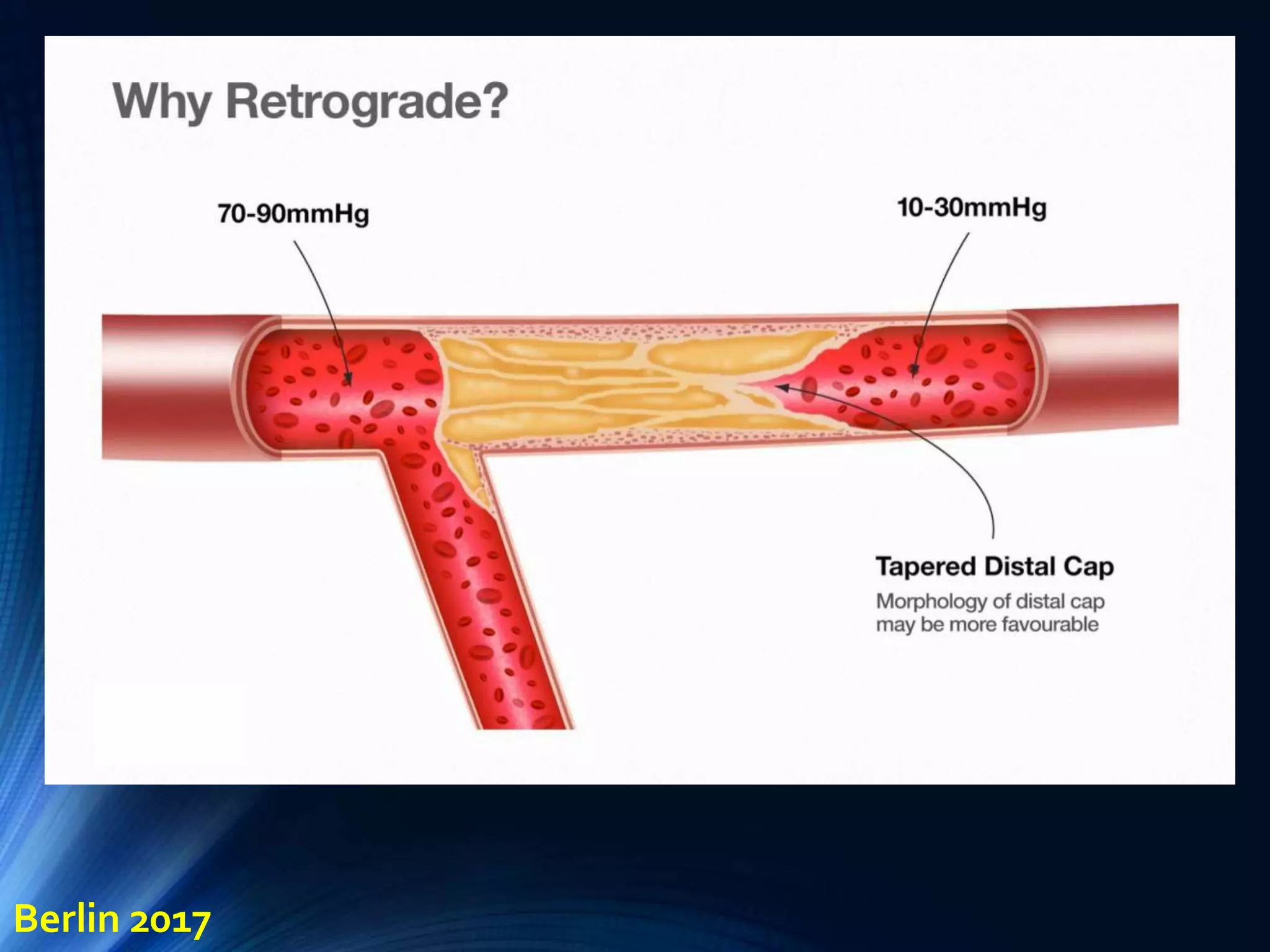 Retrograde – step by step approach | PPTX