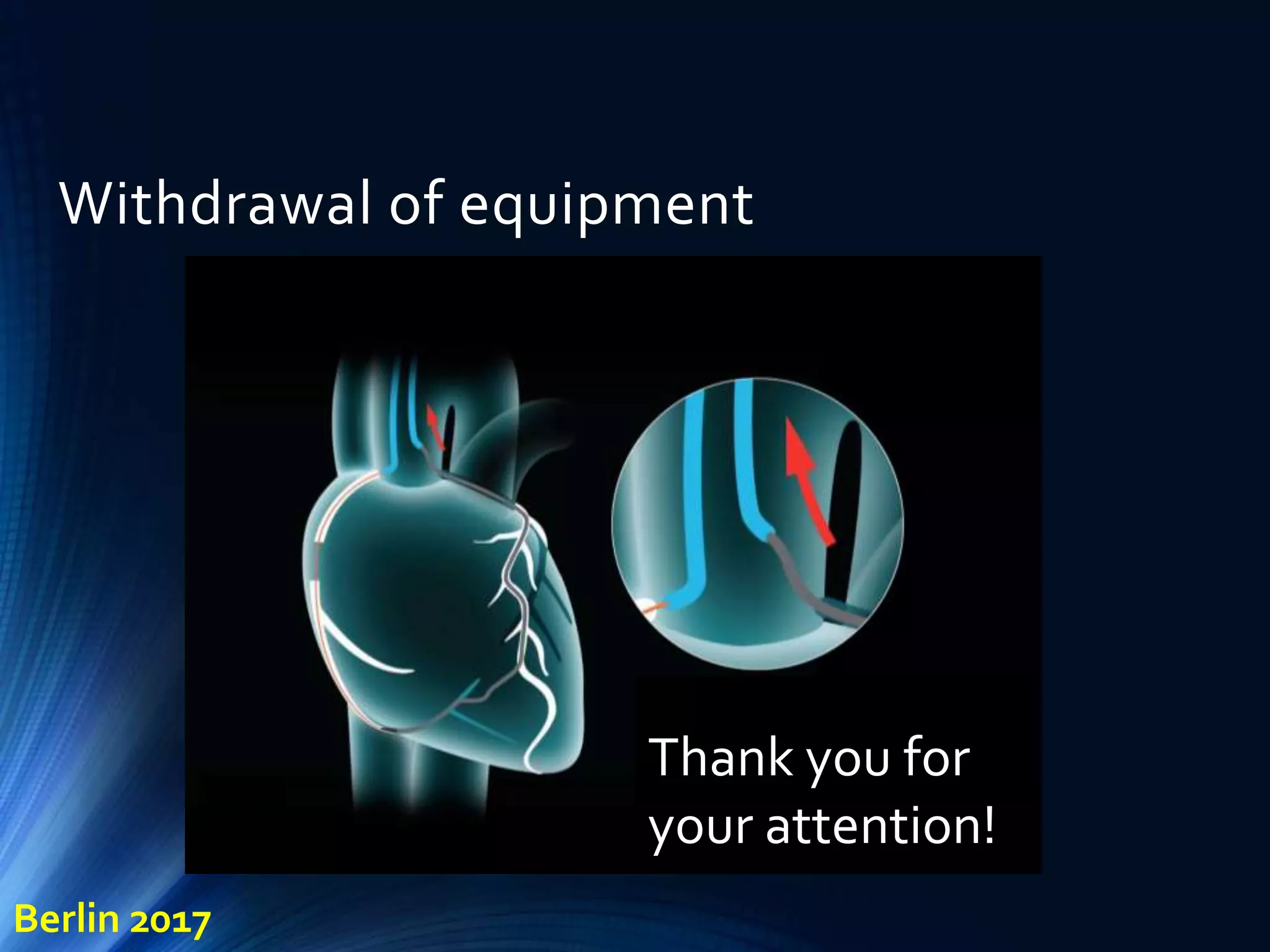 Retrograde – step by step approach | PPTX
