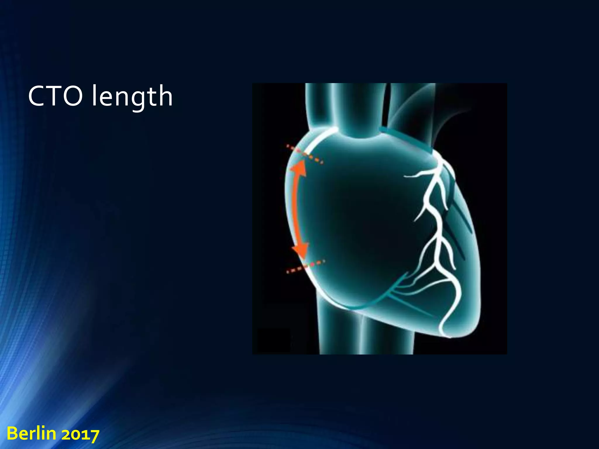 Retrograde – step by step approach | PPTX