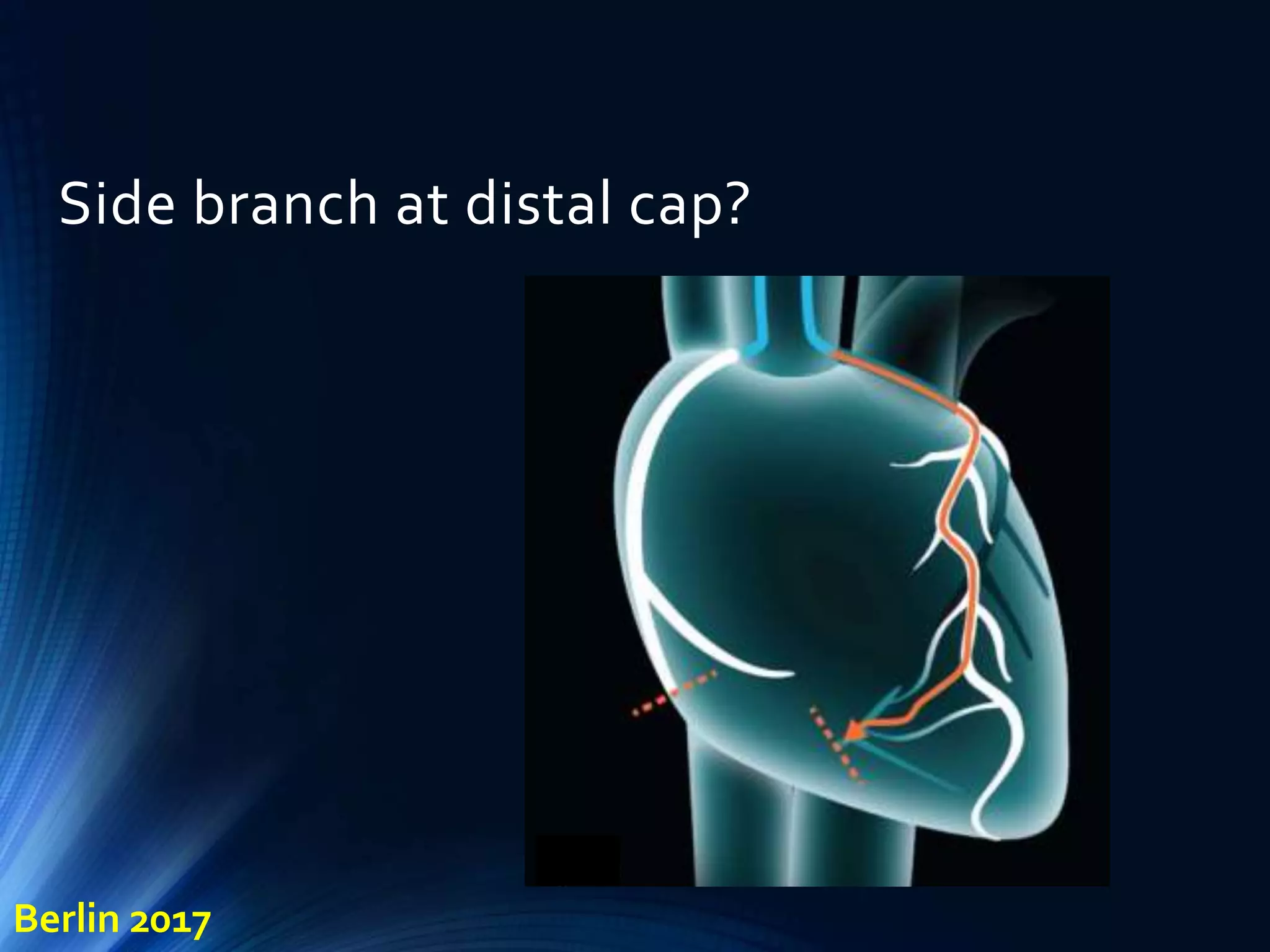 Retrograde – step by step approach | PPTX