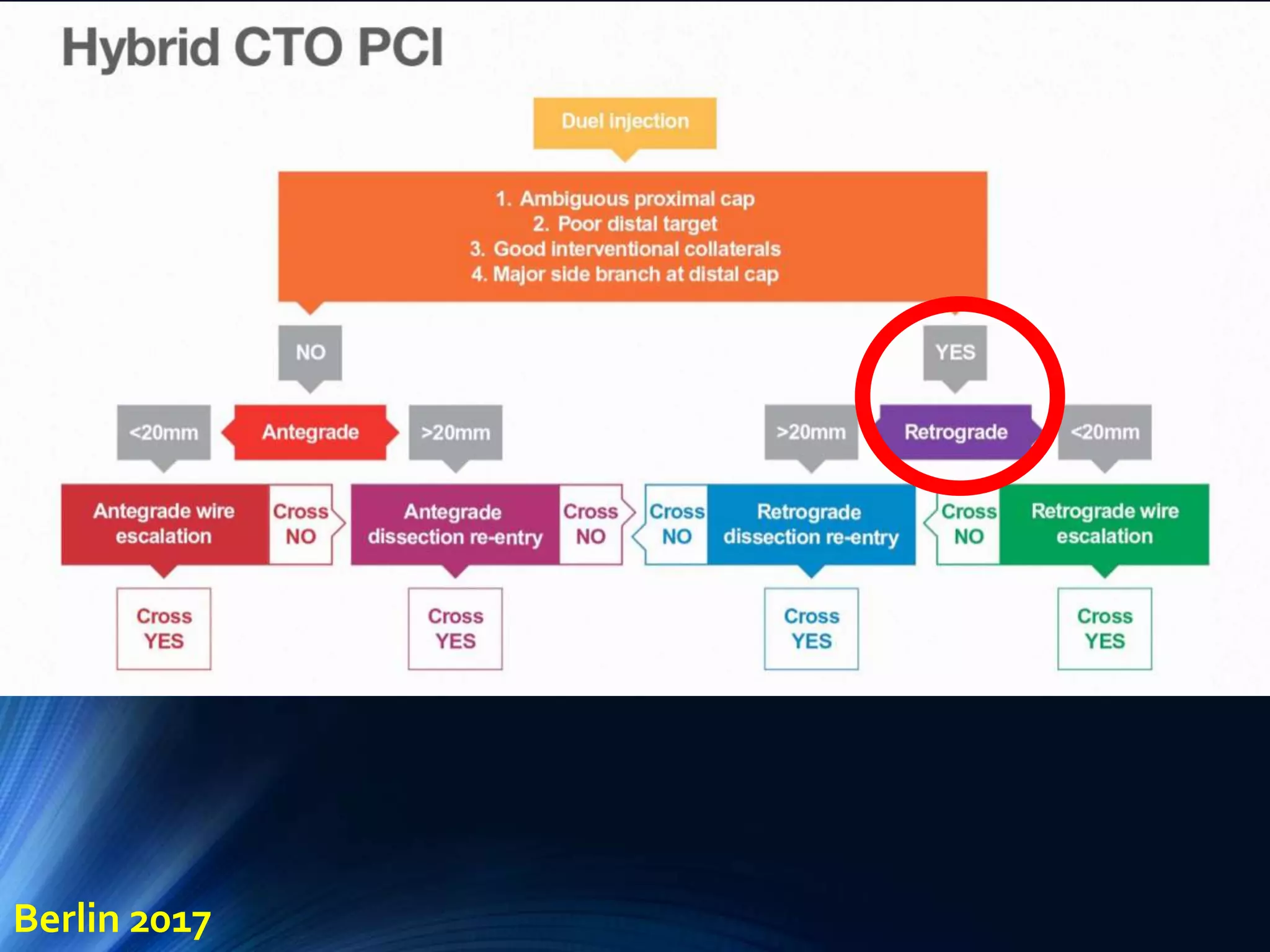 Retrograde – step by step approach | PPTX