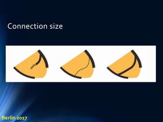 Retrograde – step by step approach | PPTX