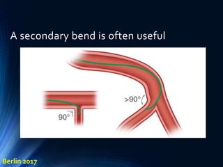 Retrograde – step by step approach | PPTX