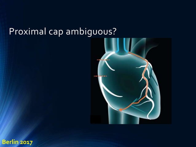 Retrograde – step by step approach | PPTX | Heart and Cardiovascular ...