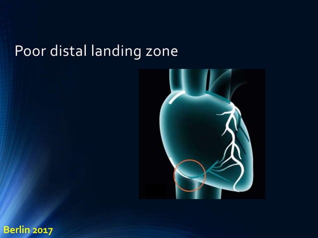 Retrograde – step by step approach | PPTX | Heart and Cardiovascular ...