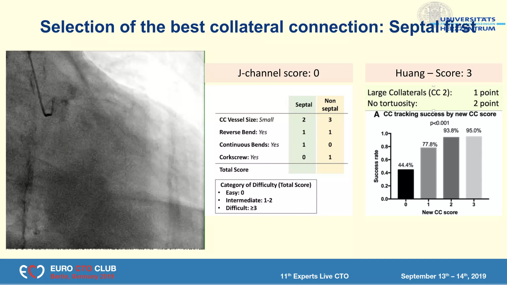 Retrograde approach Step by Step | PDF
