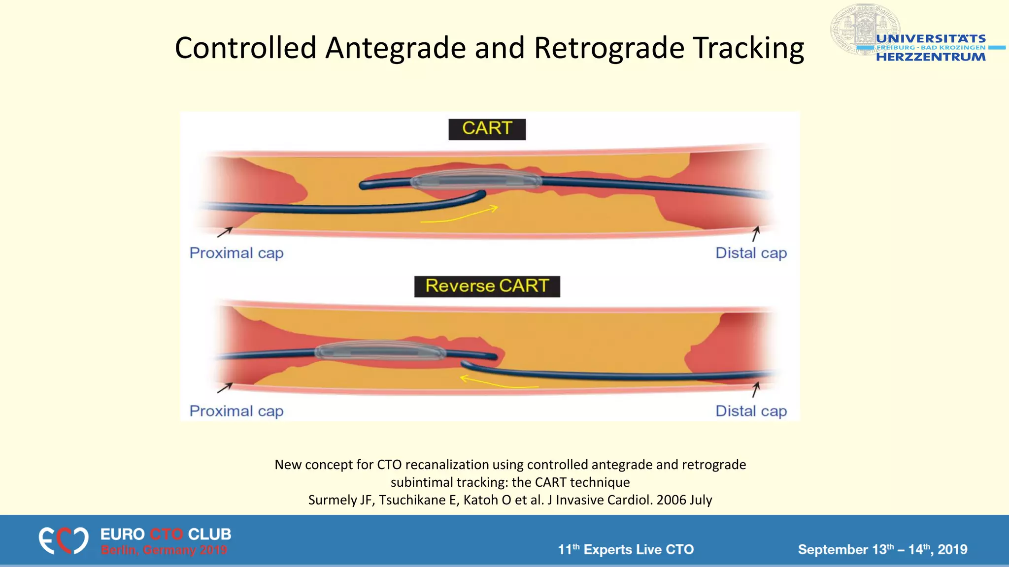 Retrograde approach Step by Step | PPT