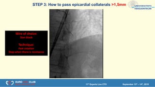Retrograde approach Step by Step | PPT