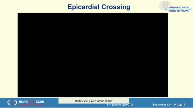 Retrograde approach Step by Step | PPT