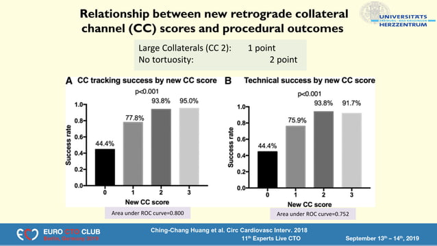 Retrograde approach Step by Step | PPT
