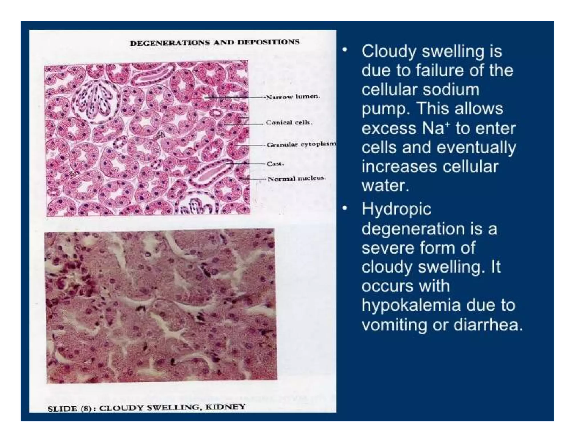 RETROGRESSIVE CHANGES.pptx