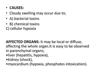 RETROGRESSIVE CHANGES.pptx