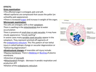 RETROGRESSIVE CHANGES.pptx