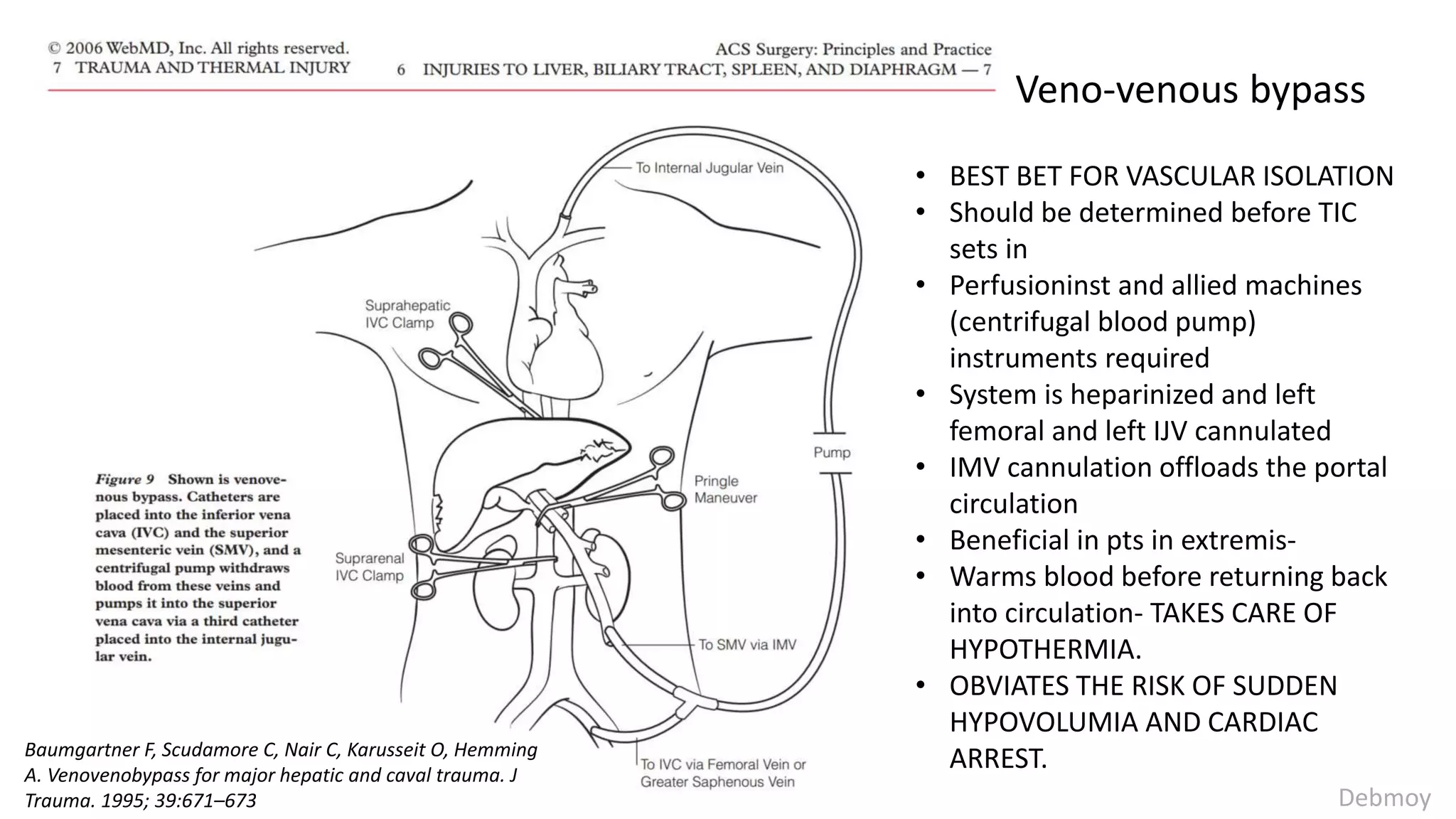 Retrohepatic IVC Injuries Evaluation and Assessment.pptx