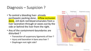 Retrohepatic IVC Injuries Evaluation and Assessment.pptx