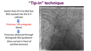 Retrograde microcather cannot cross the lesion: tips & tricks | PDF
