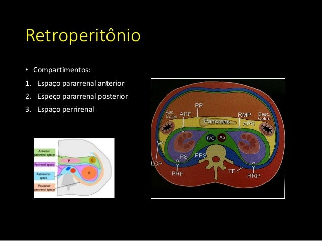 Ultrassom do Retroperitônio e Peritônio