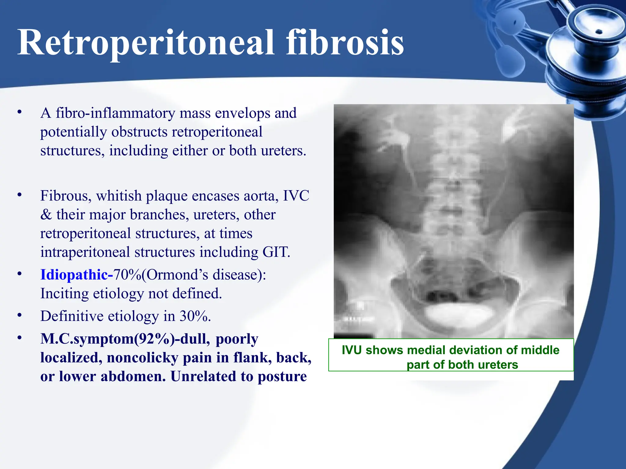 retroperitoneal-tumors for medical doctors | PPT