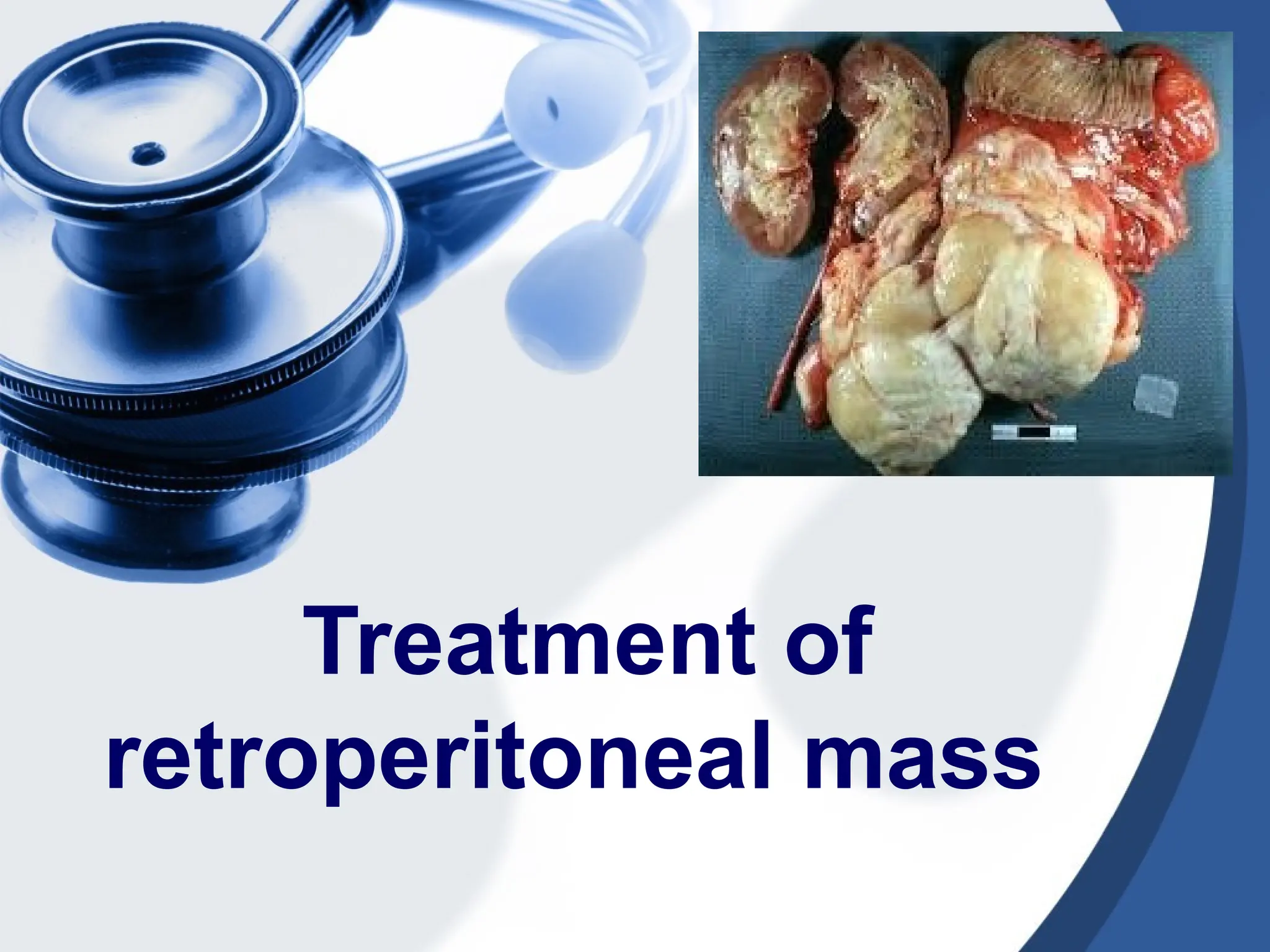 retroperitoneal-tumors for medical doctors | PPT