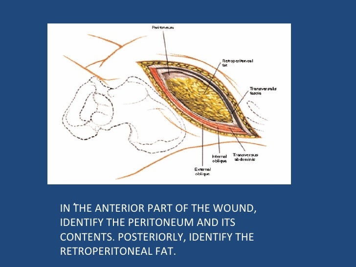 Retroperitoneal Approach To The Lumbar Spine1