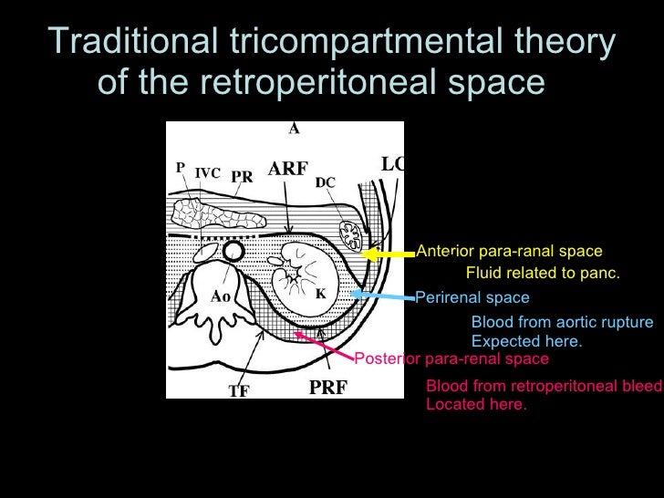 Retroperitoneal Abscess 3 Radrounds Radiology Network