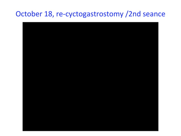 Retroperitoneal endoscopic necrosectomy | PPT | Digestive Disorders ...