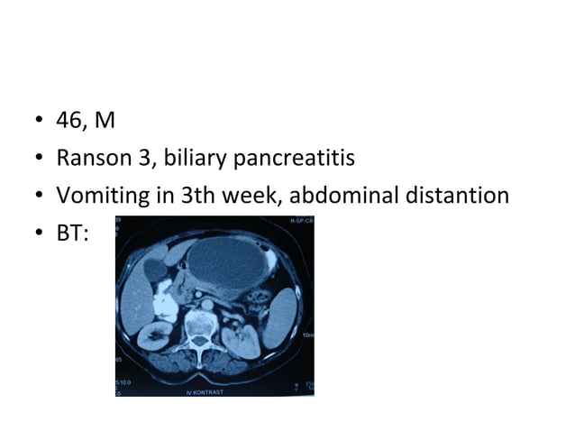 Retroperitoneal endoscopic necrosectomy | PPT | Digestive Disorders ...