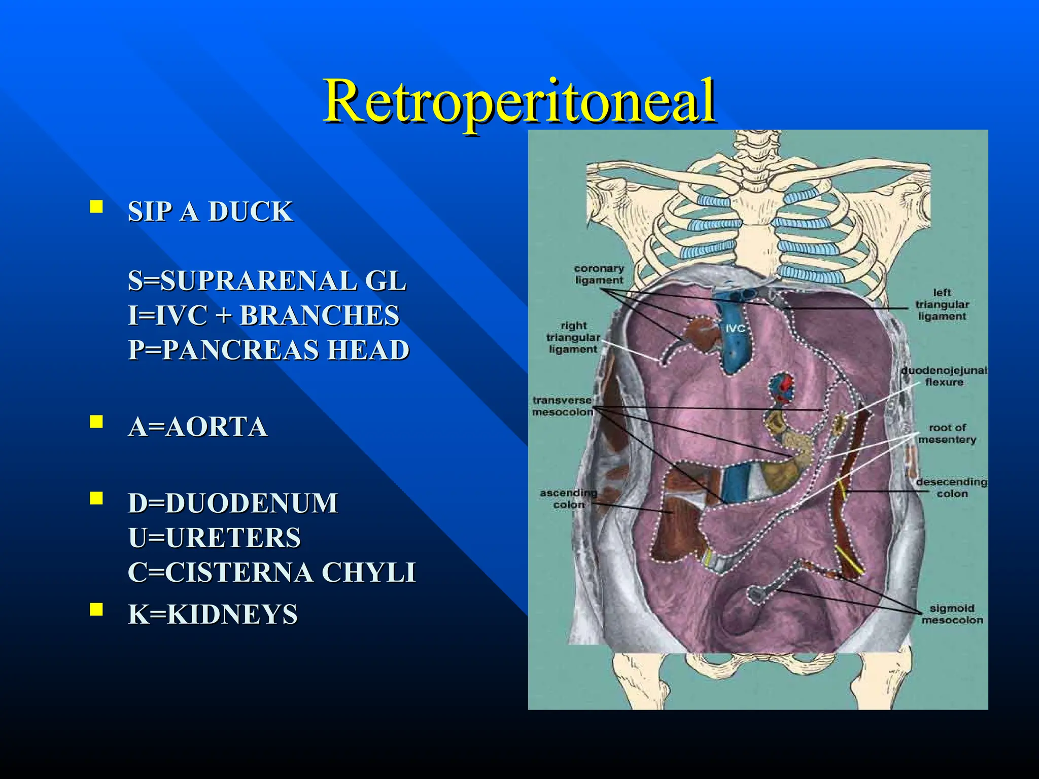 Retroperitoneal Hematoma causes and management the lect.ppt