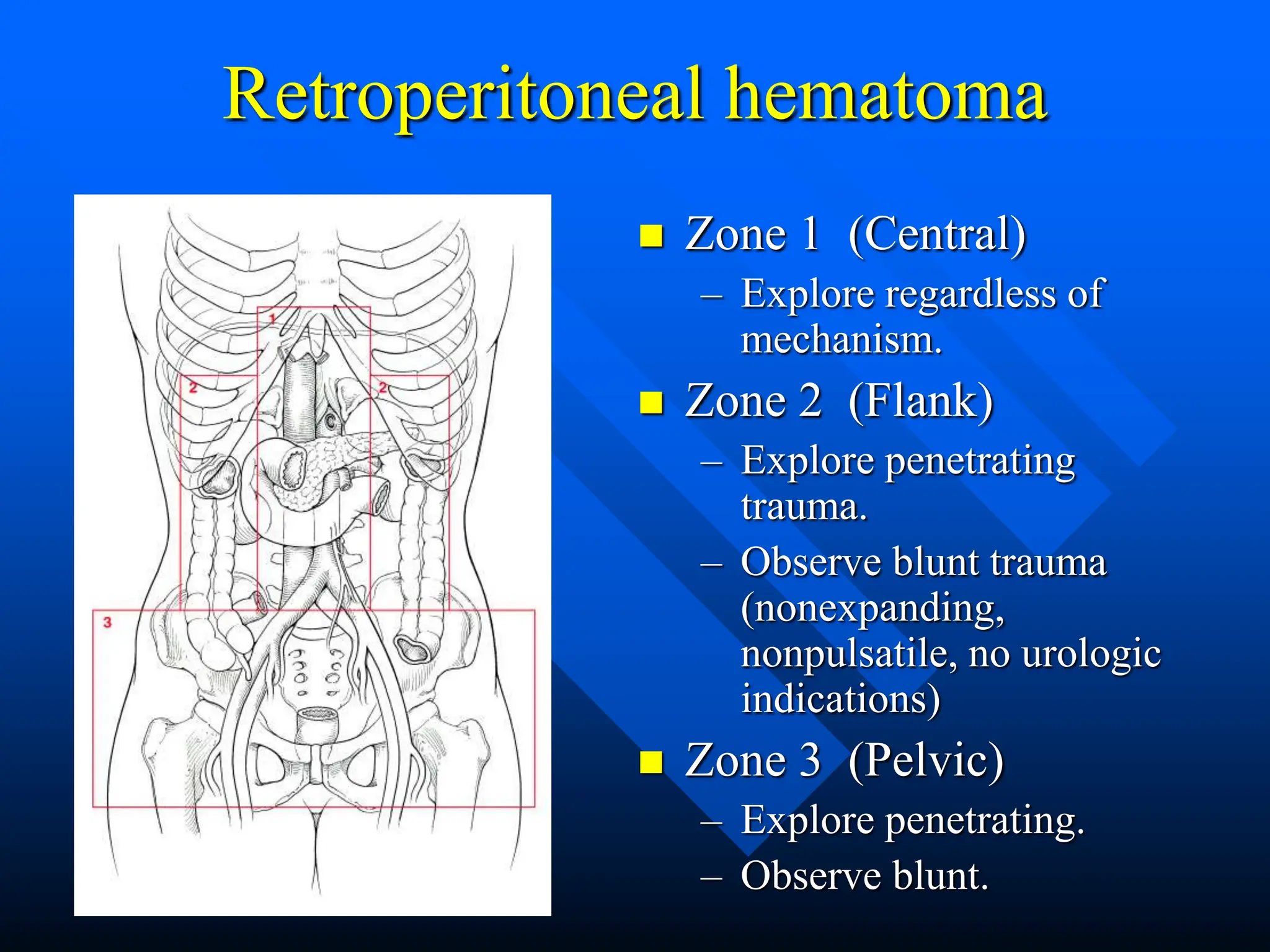 Retroperitoneal Hematoma types and management the lect.ppt