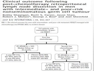 Retroperitoneal Lymph Nodes
