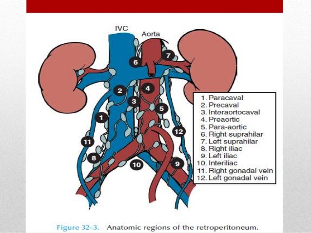 Retroperitoneal Lymph Node Dissection