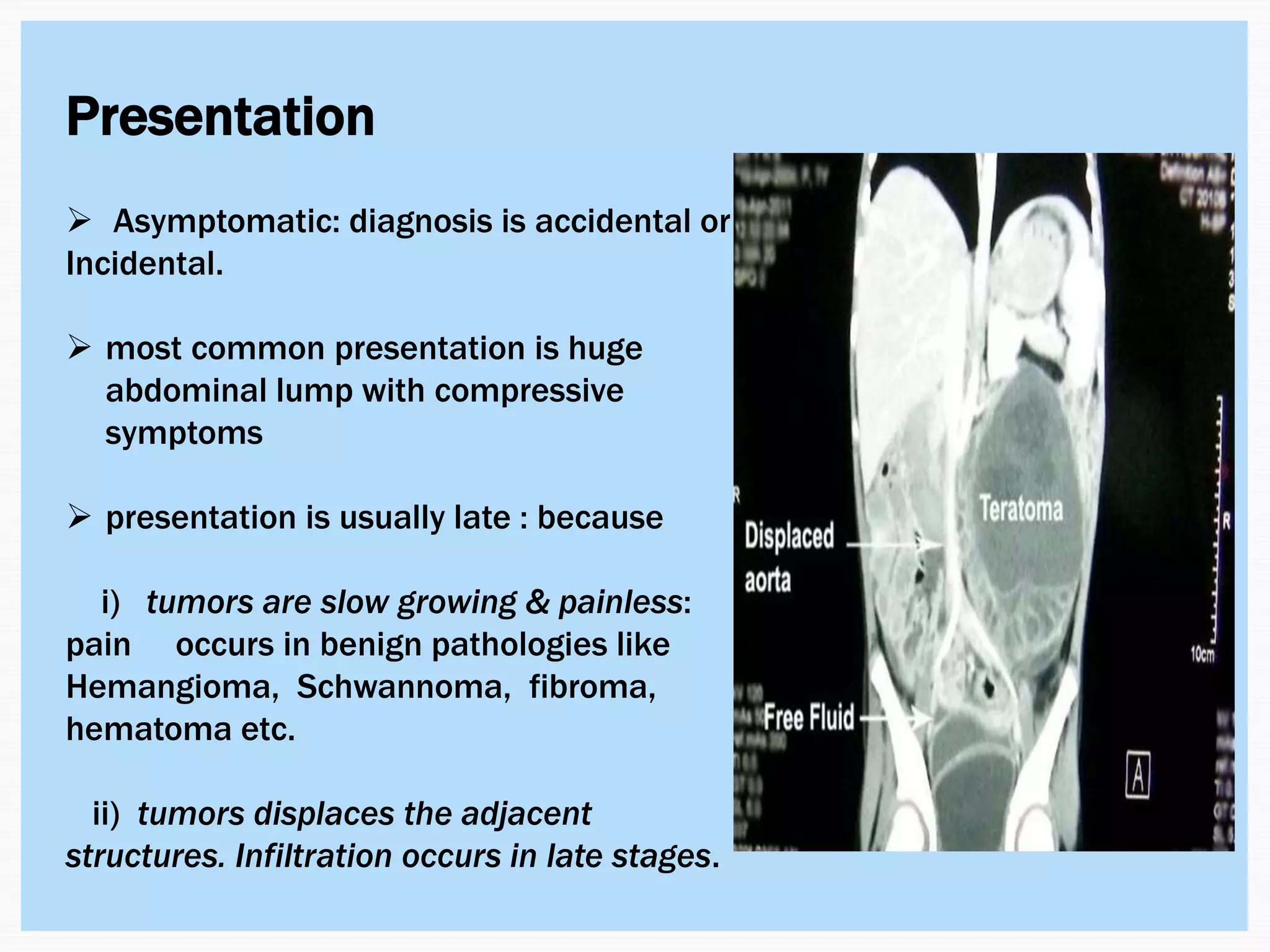 Retroperitoneal mass | PPTX