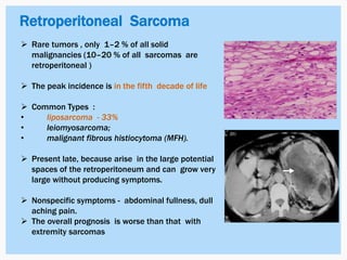 Retroperitoneal mass | PPT