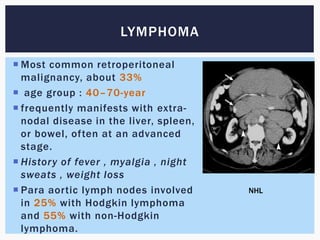Retroperitoneal mass | PPT