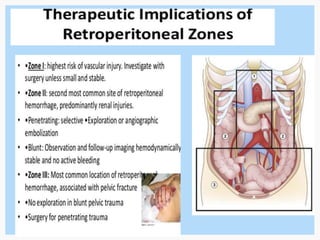 Retroperitoneal mass | PPTX