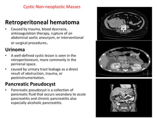 Retroperitoneal mass.pptx