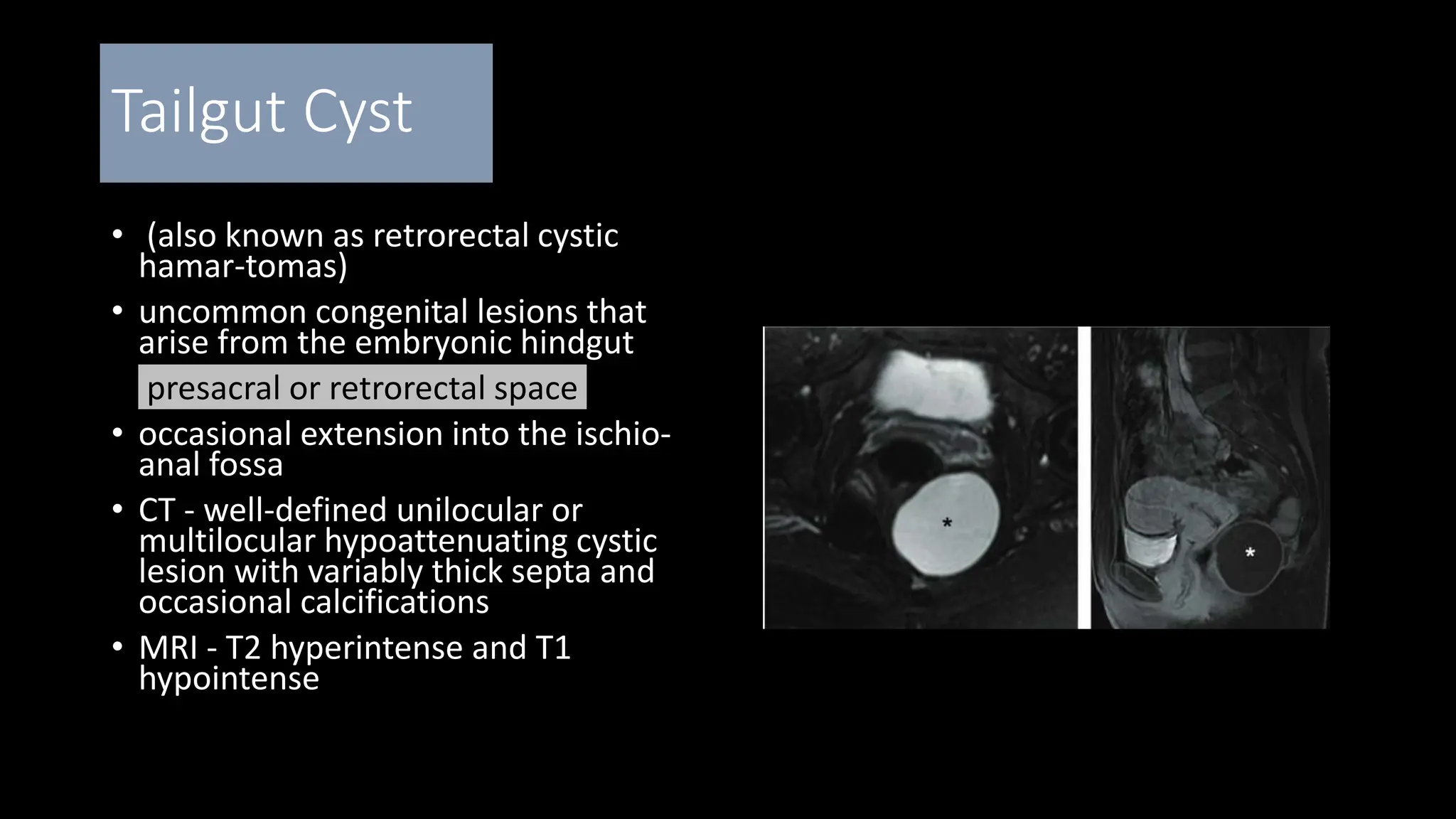 retroperitoneal mass and retroperitoneal anatomy | PPTX