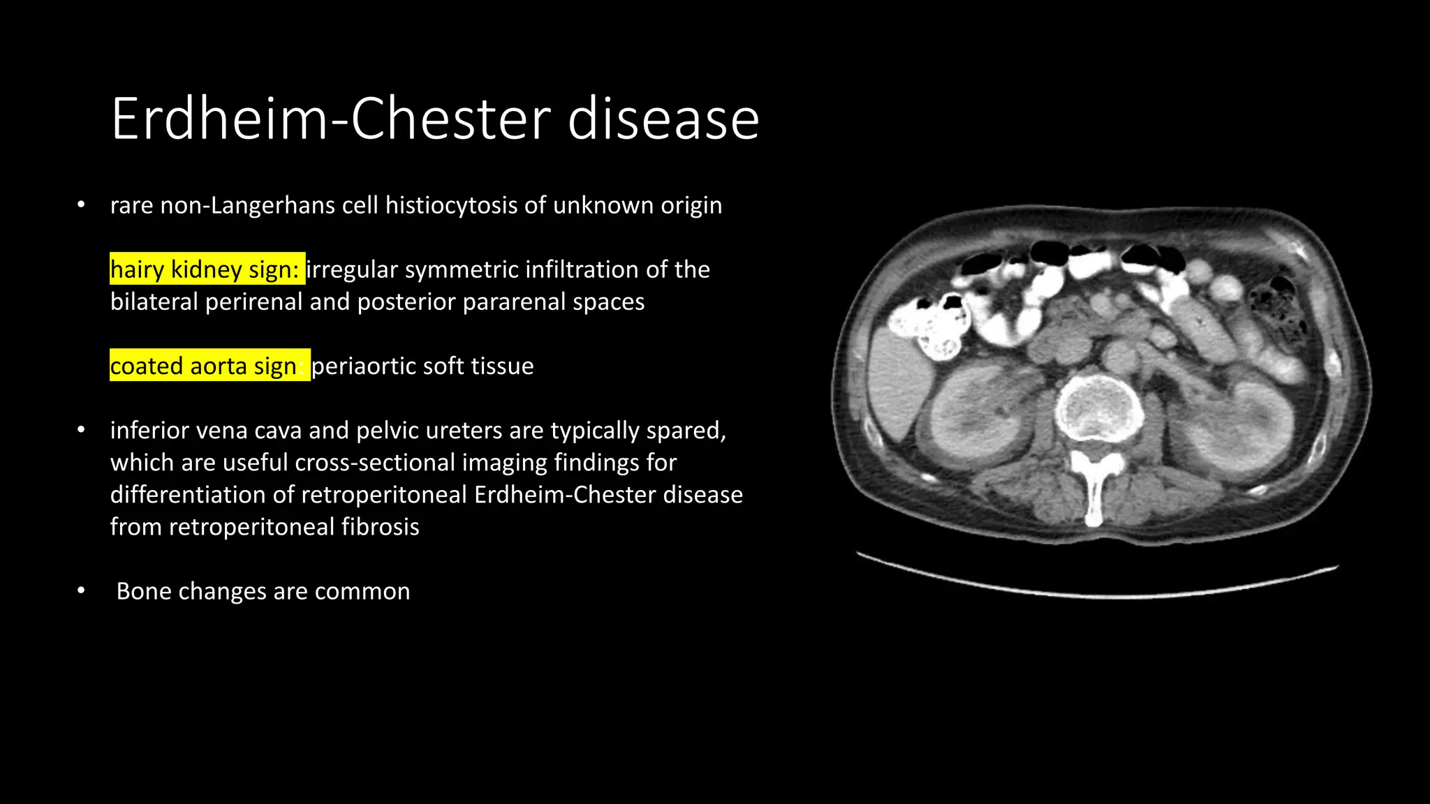 retroperitoneal mass and retroperitoneal anatomy | PPTX
