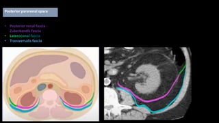 retroperitoneal mass and retroperitoneal anatomy | PPTX | Blood ...