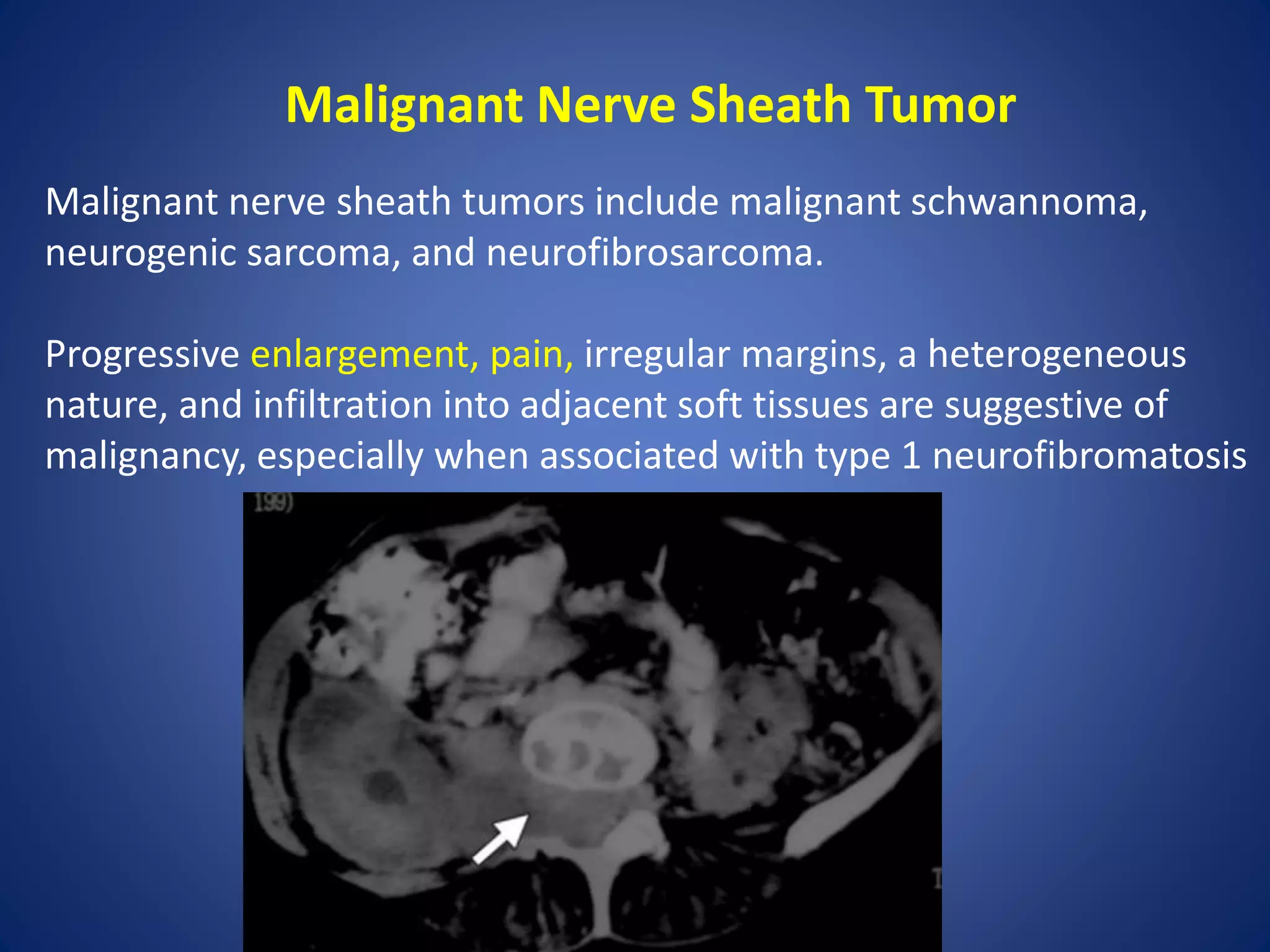 Retroperitoneal masses radiology | PPTX