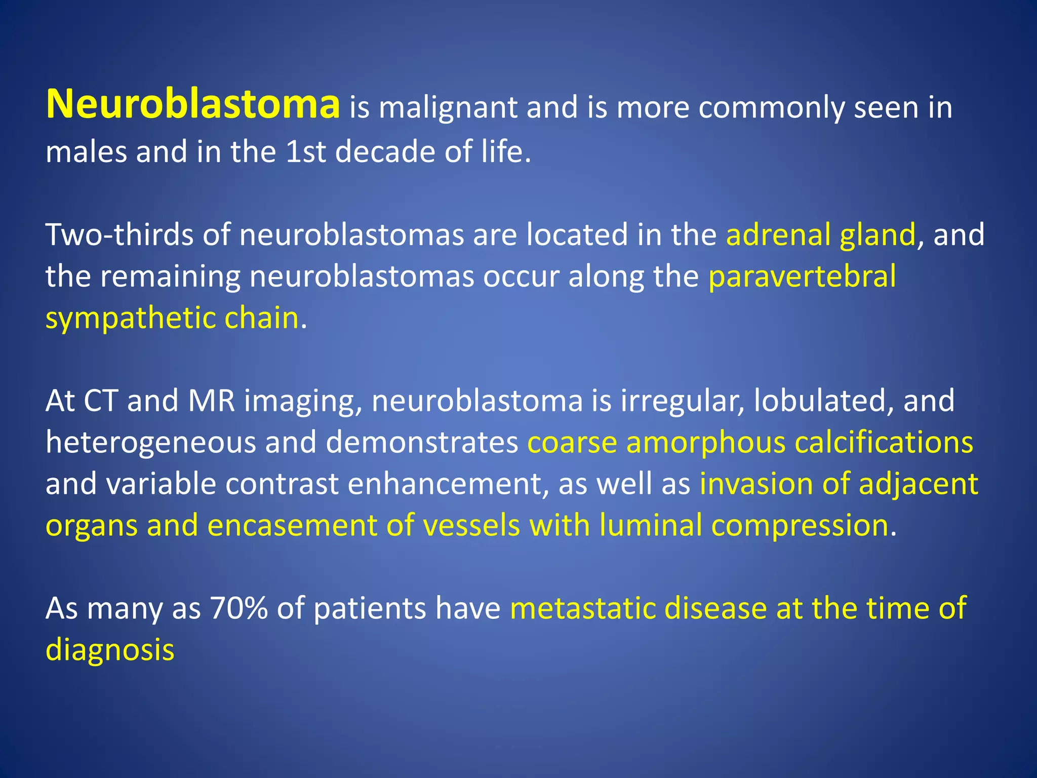 Retroperitoneal masses radiology | PPTX