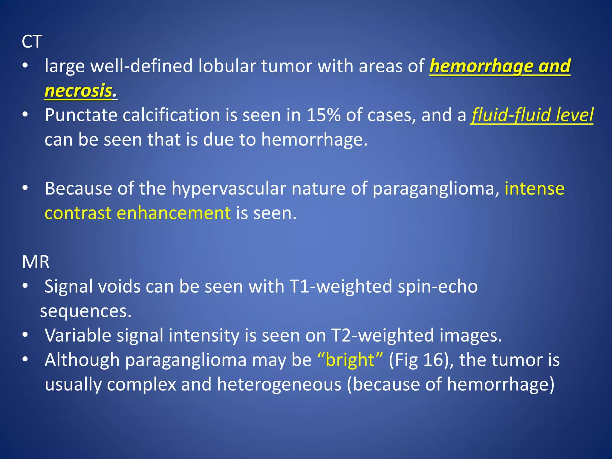 Retroperitoneal masses radiology | PPTX