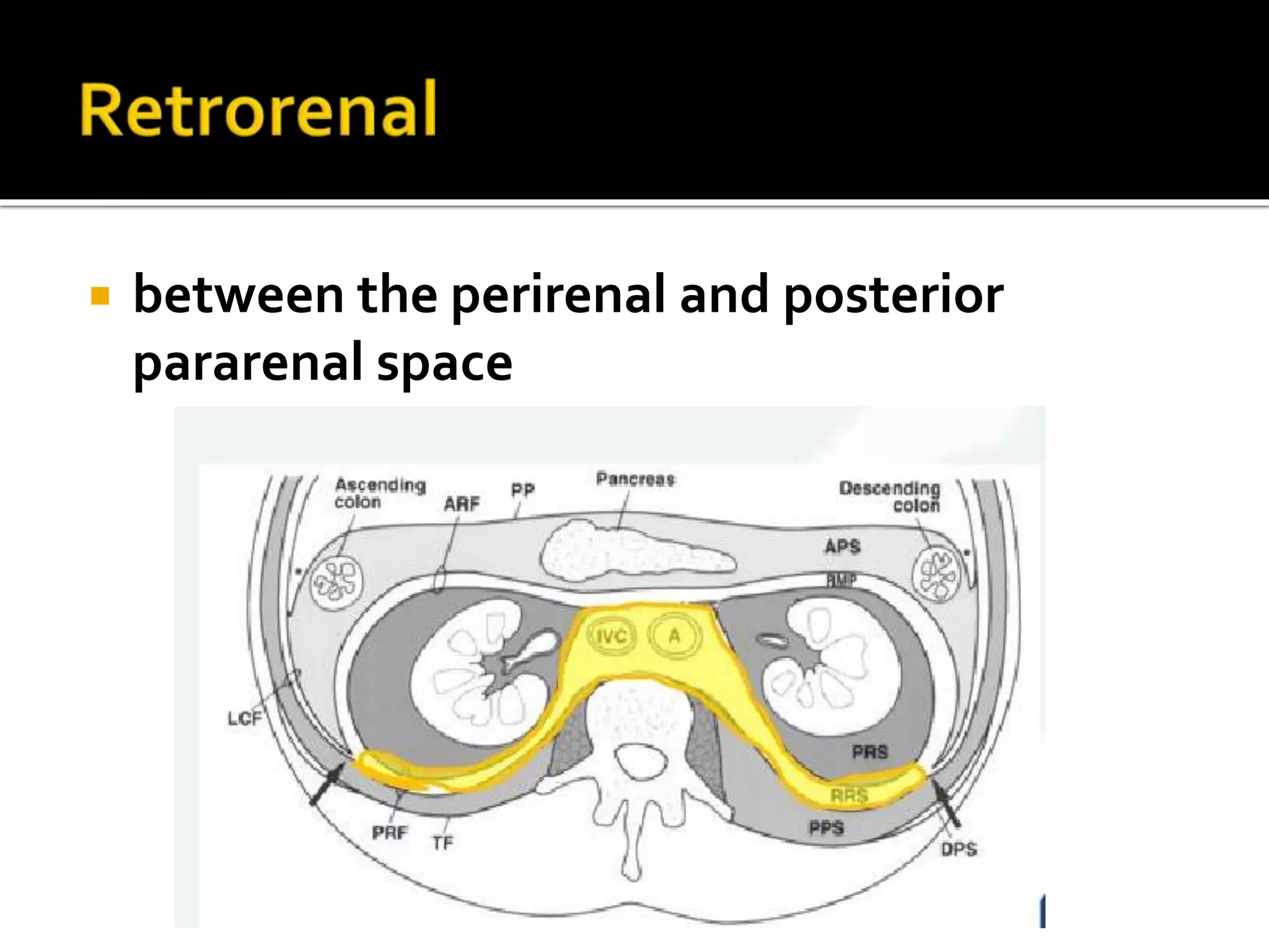 Retroperitoneal space | PPTX