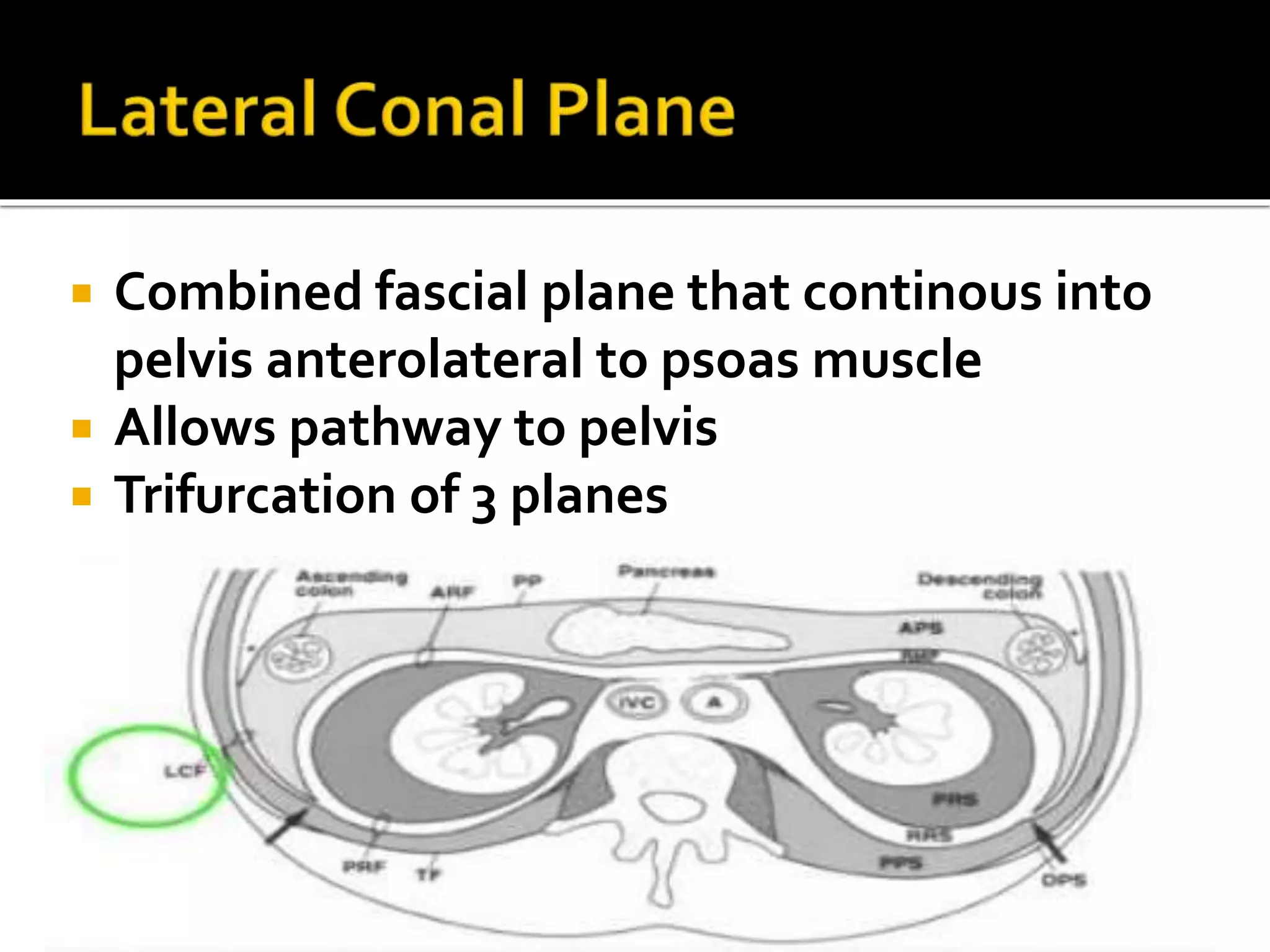 Retroperitoneal space | PPTX